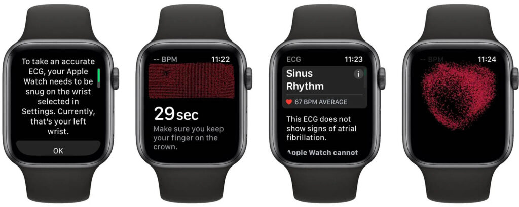 How To Take ECG (Electrocardiogram) on Apple Watch With ECG App